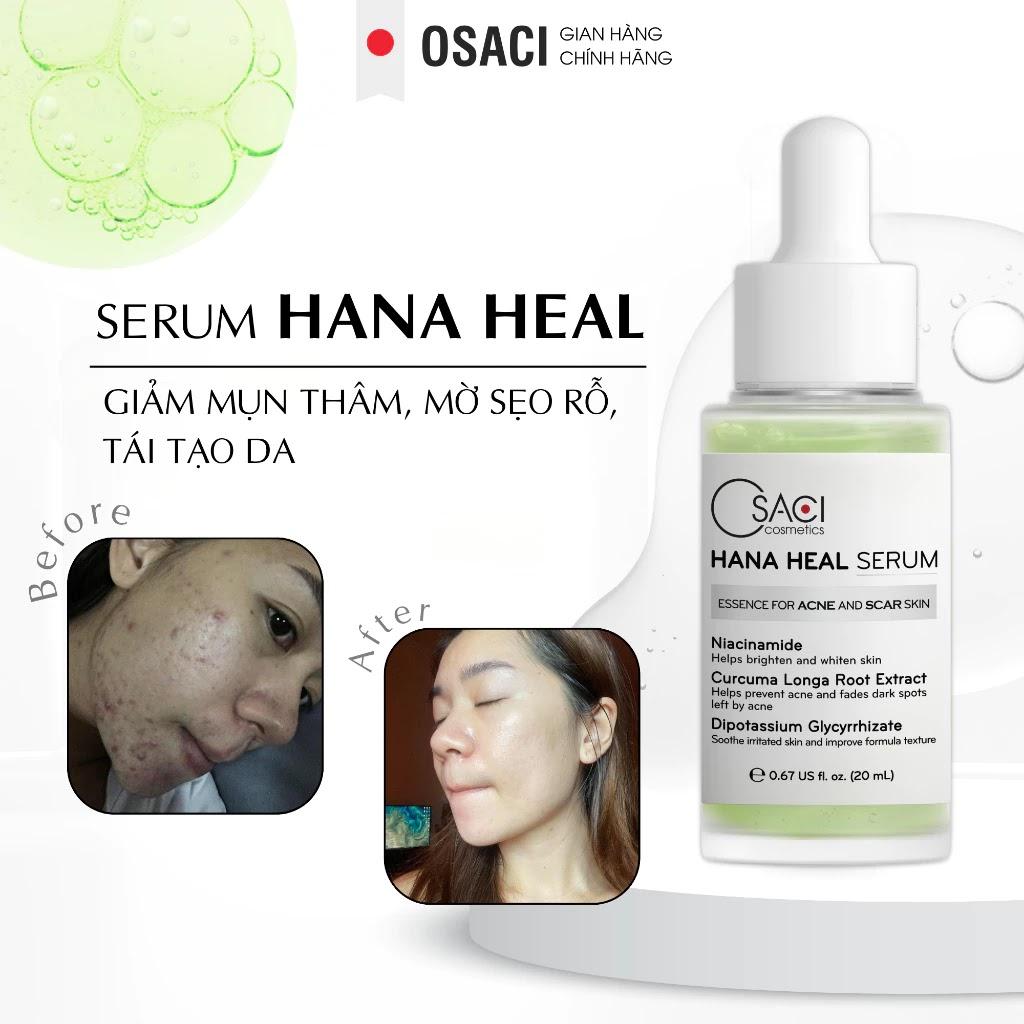 Form điền nội dung đăng kí KOC/KOL quảng bá sản phẩm thương hiệu Osaci